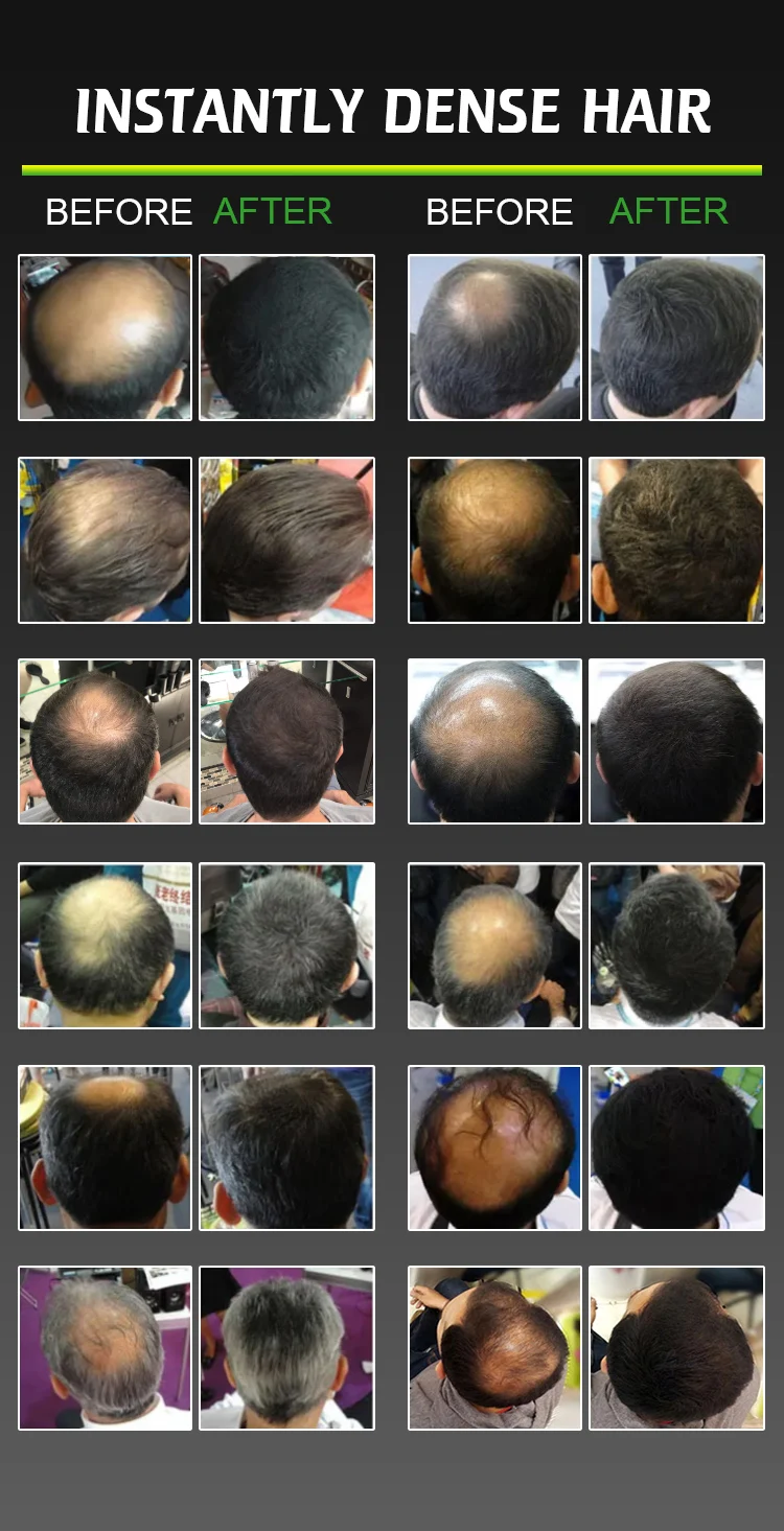 Hair Building Fibers - Natural Solutions for Thinning Hair