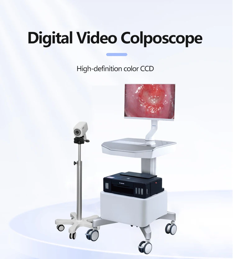 Disposable Endoscopic Submucosal Digital Colposcope Endoscope Camera ...