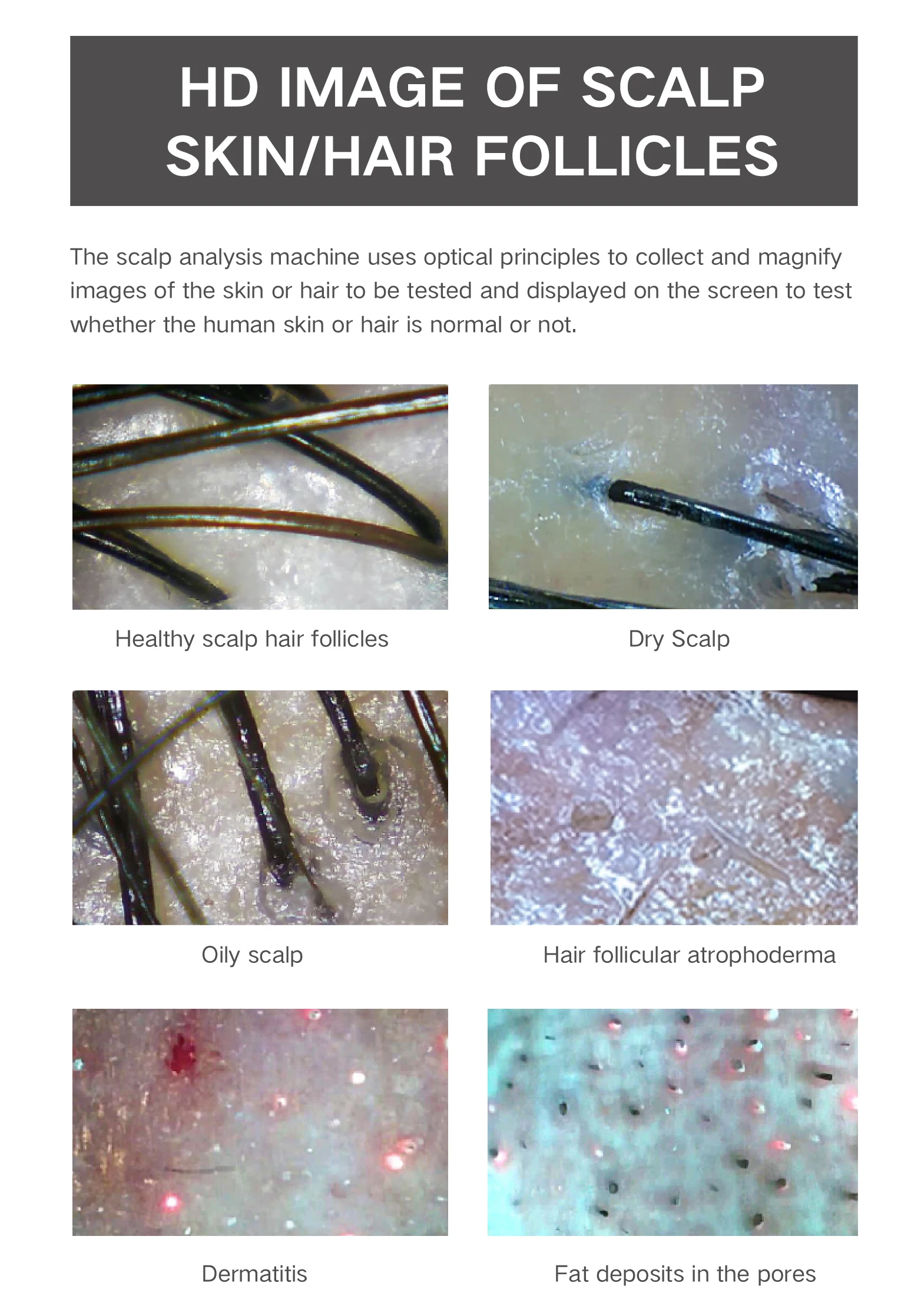 Portable HD Hair Follicles Scalp Scanner - Salon Beauty Analyzer