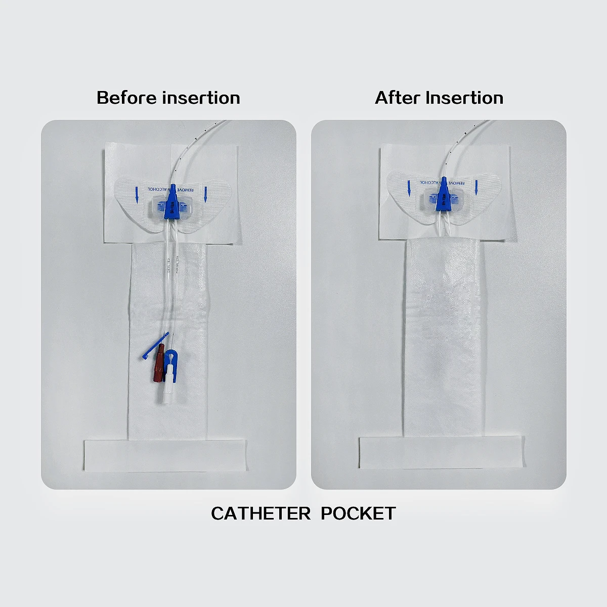 Hemodialysis Catheter Protector - Non Woven Fabric Pouch