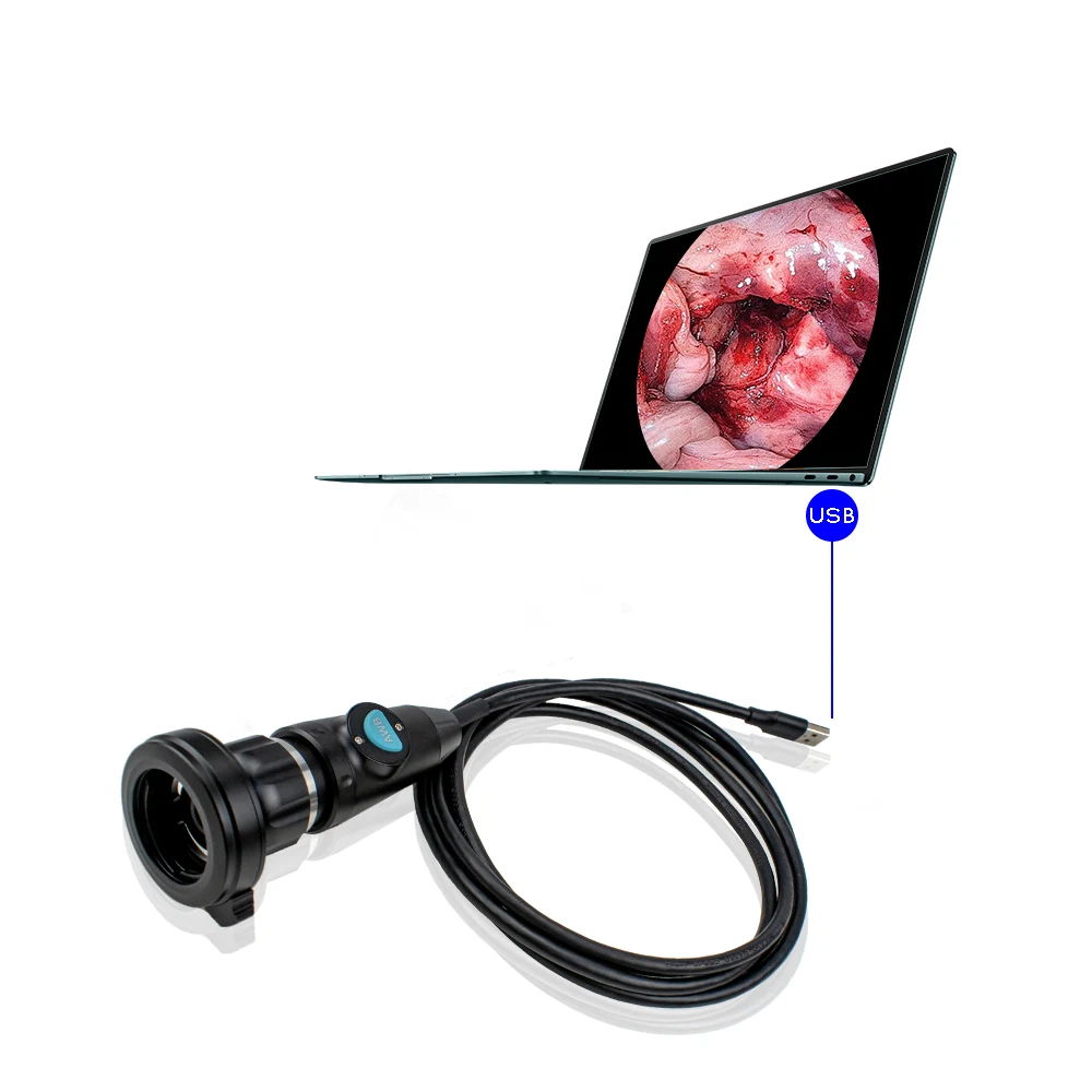 Portable Optical Adapter Medical Full HD Endoscope USB Camera Unit ...