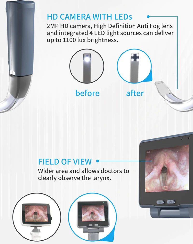 CONTEC CMS-GS1 Video Laryngoscope - Affordable & Reliable