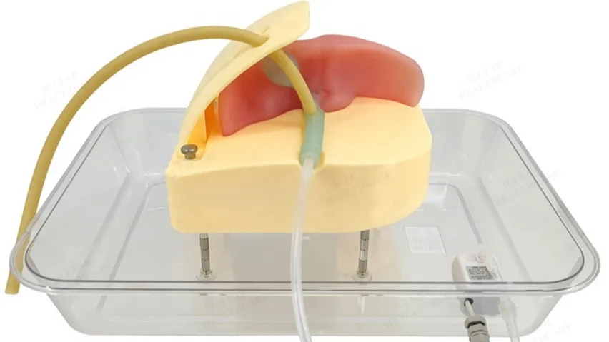 Choledochoscope Training Simulator Hepatobiliary Model Of T Tube Stone ...