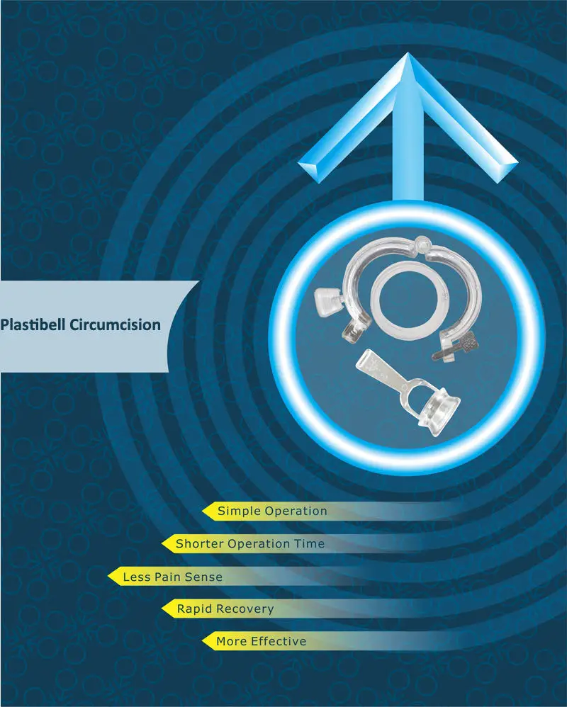 Sterile Painless Medical Cosmetic Plastibell Circumcision Instrument ...