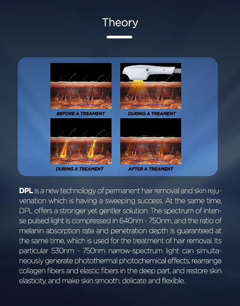 ADSS DPL Laser Skin Rejuvenation - Acne & Pigmentation Treatment