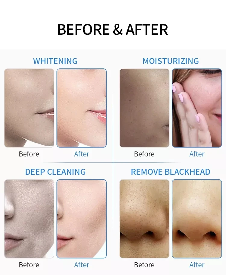 Uni Pretty H2o2 Hydrofacials Machine Hidrofacial Wholesale Hydra ...