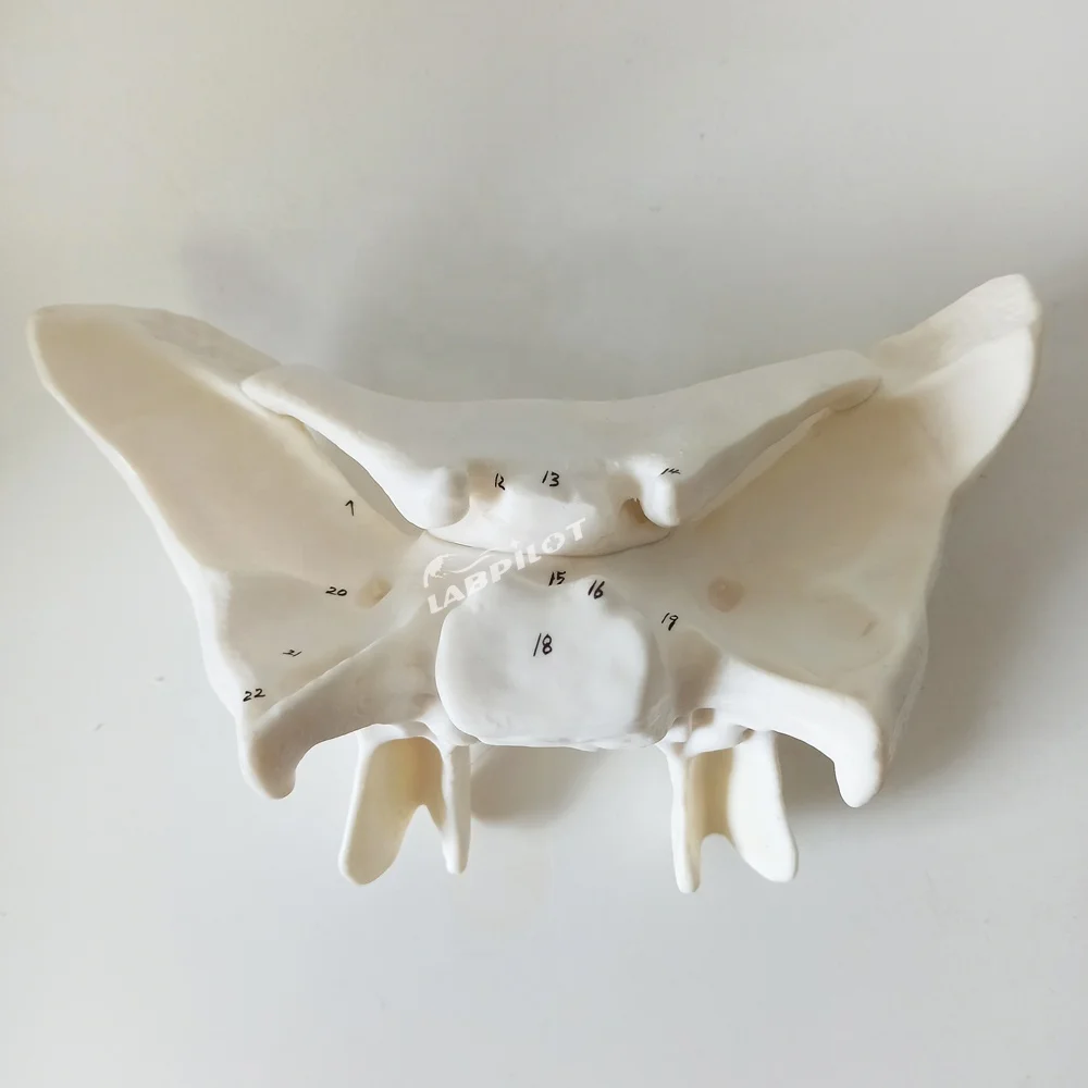 Amplified Alar Bone Sphenoid Bone Medical Teaching Model