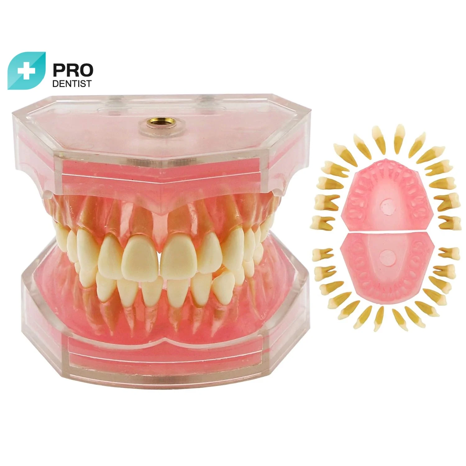 Orthodontic Typodonts Model - Gum Wax Embankment Teeth Practice Model ...