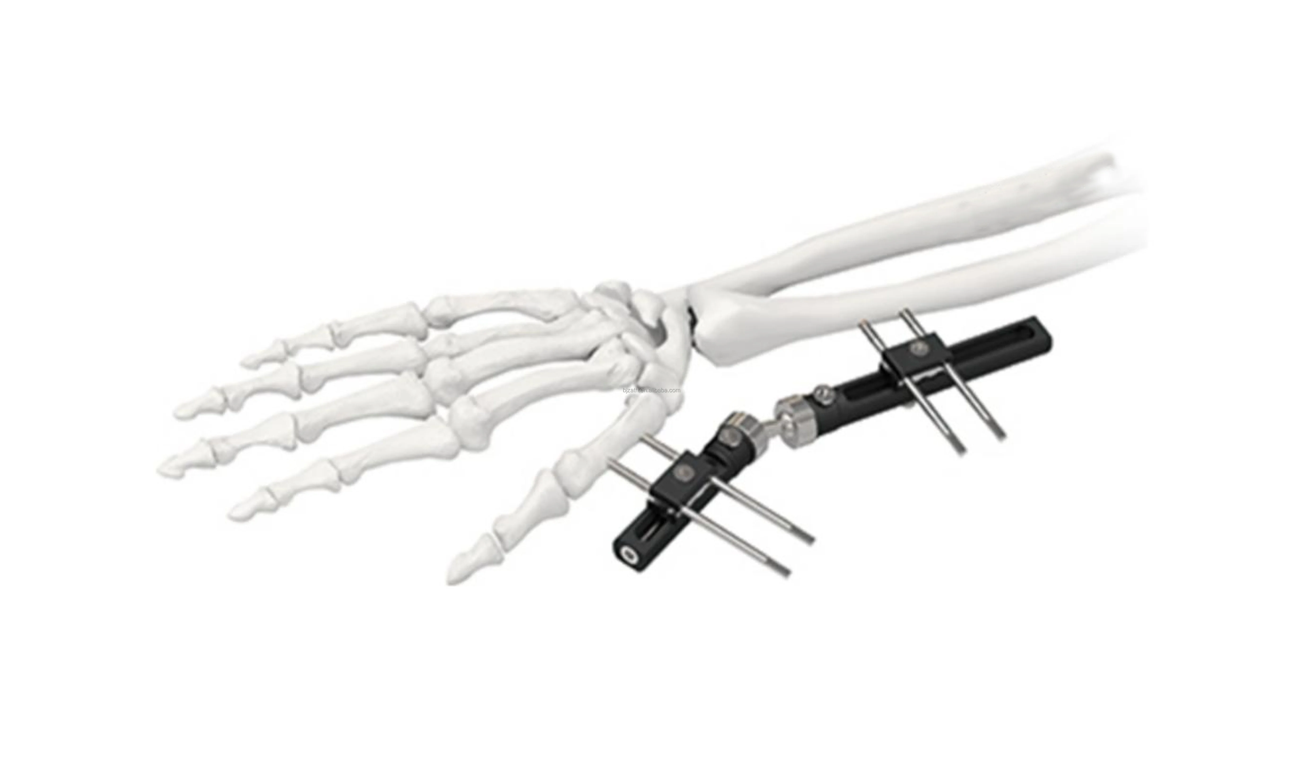 High Quality Factory Price Wrist Joint Frame Wrist Fracture Fixation ...
