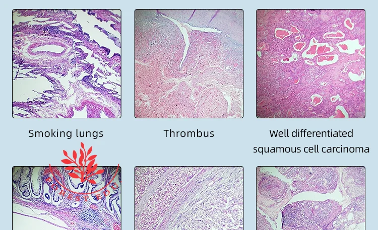 Human Pathology Slide FRT2002 Human Pathology Slices Educational Supply ...