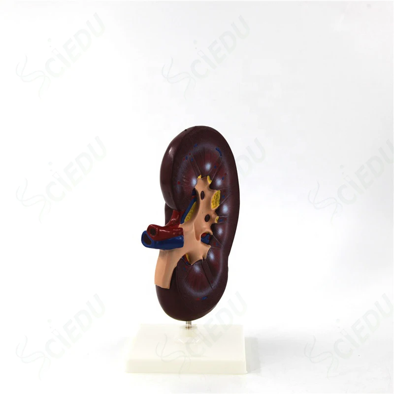 Medical Science Anatomy Kidney Model Teaching Resource Aids Anatomy ...