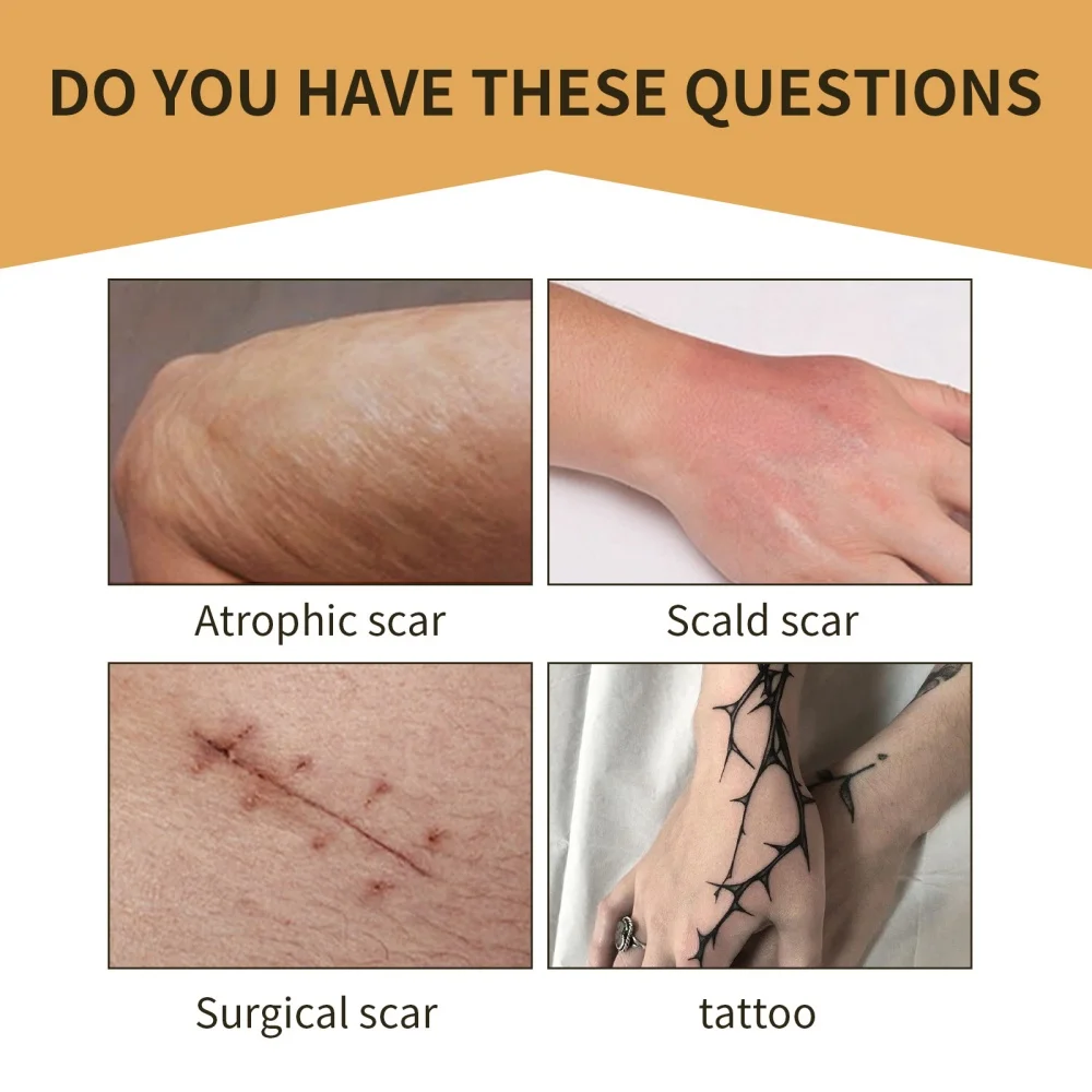 Multi-use Invisible Covering Patch Waterproof Patch Scar Covering ...