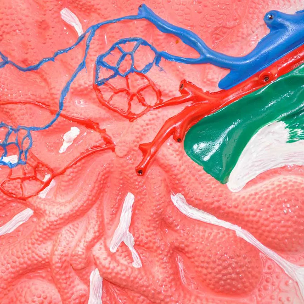 Enlarged Lymph Node Model Biology Teaching Scientific Teaching ...