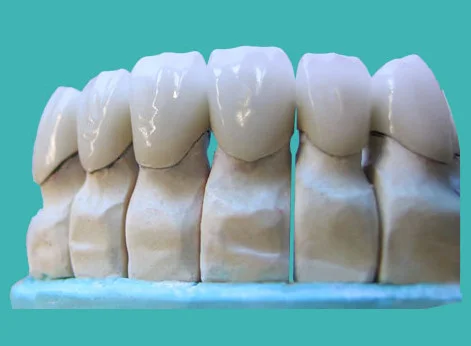 Durable Dental Teeth Prosthetics - Porcelain Fused to Metal Co-cr