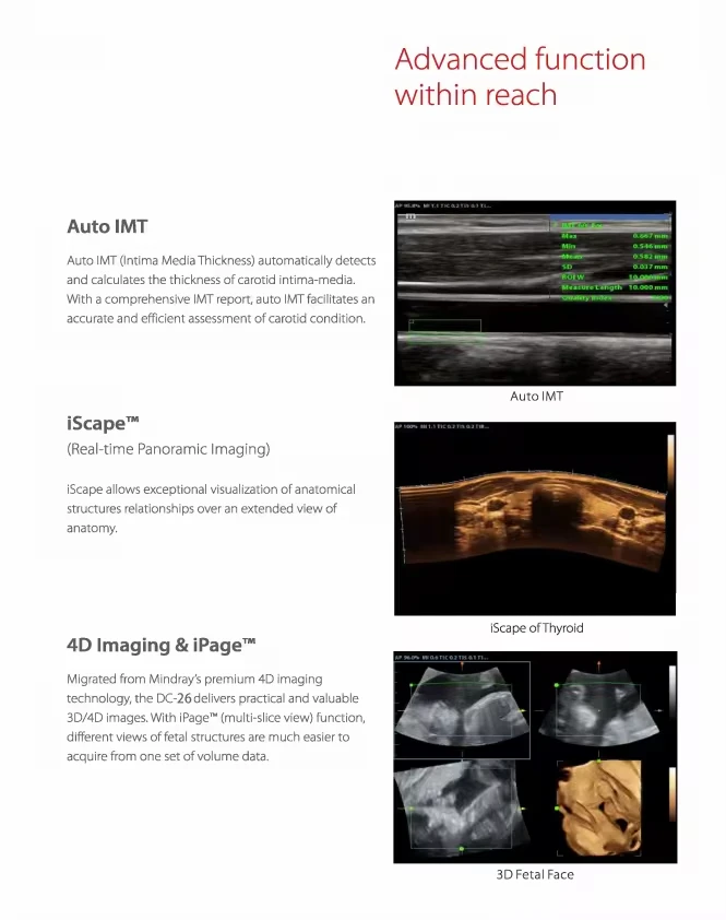 Mindray DC-26 Trolley Ultrasound Machine - Color Doppler