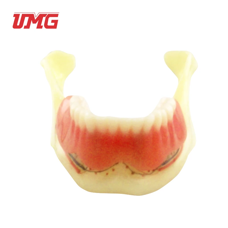 Resin Mandibular Detachable Jaw Bone Denture Model With Belt Nerve And ...