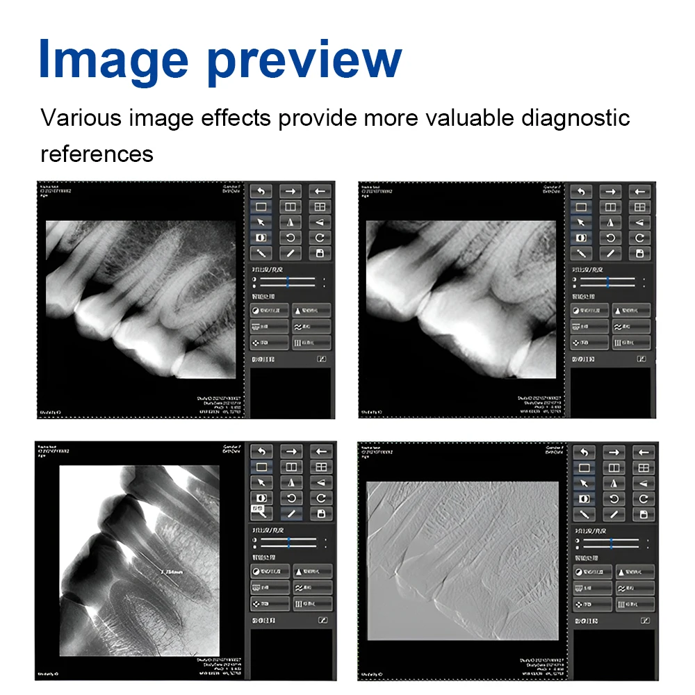 Dental Imaging Sensor X-ray Image Machine System High-frequency X Ray ...