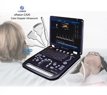 Lannx Urason Cx20 Hospital Color Doppler Ultrasound Scanner System Pregnancy 2d/3d Ultrasound ...