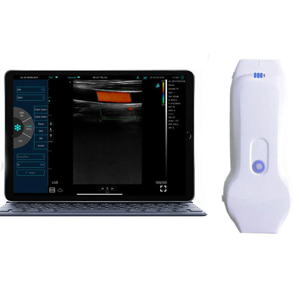 5d Handheld Ultrasound 3 in 1 Probe Scanner C10rl - Suresult