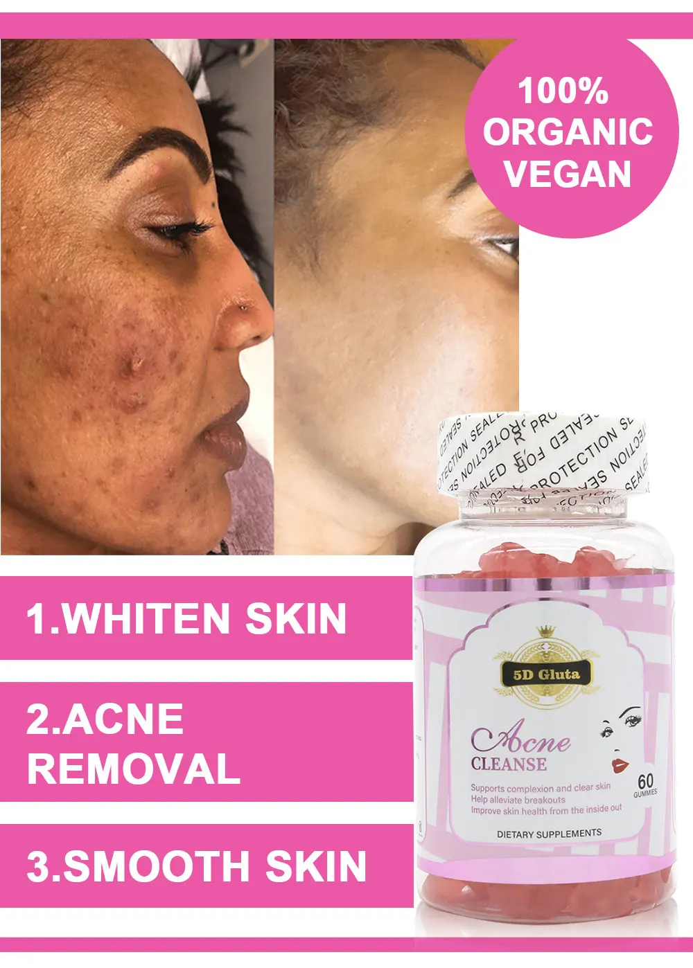 Oem Gummi Bears Vitamins A And C Remove Acne Candy Gummies - Buy Candy ...