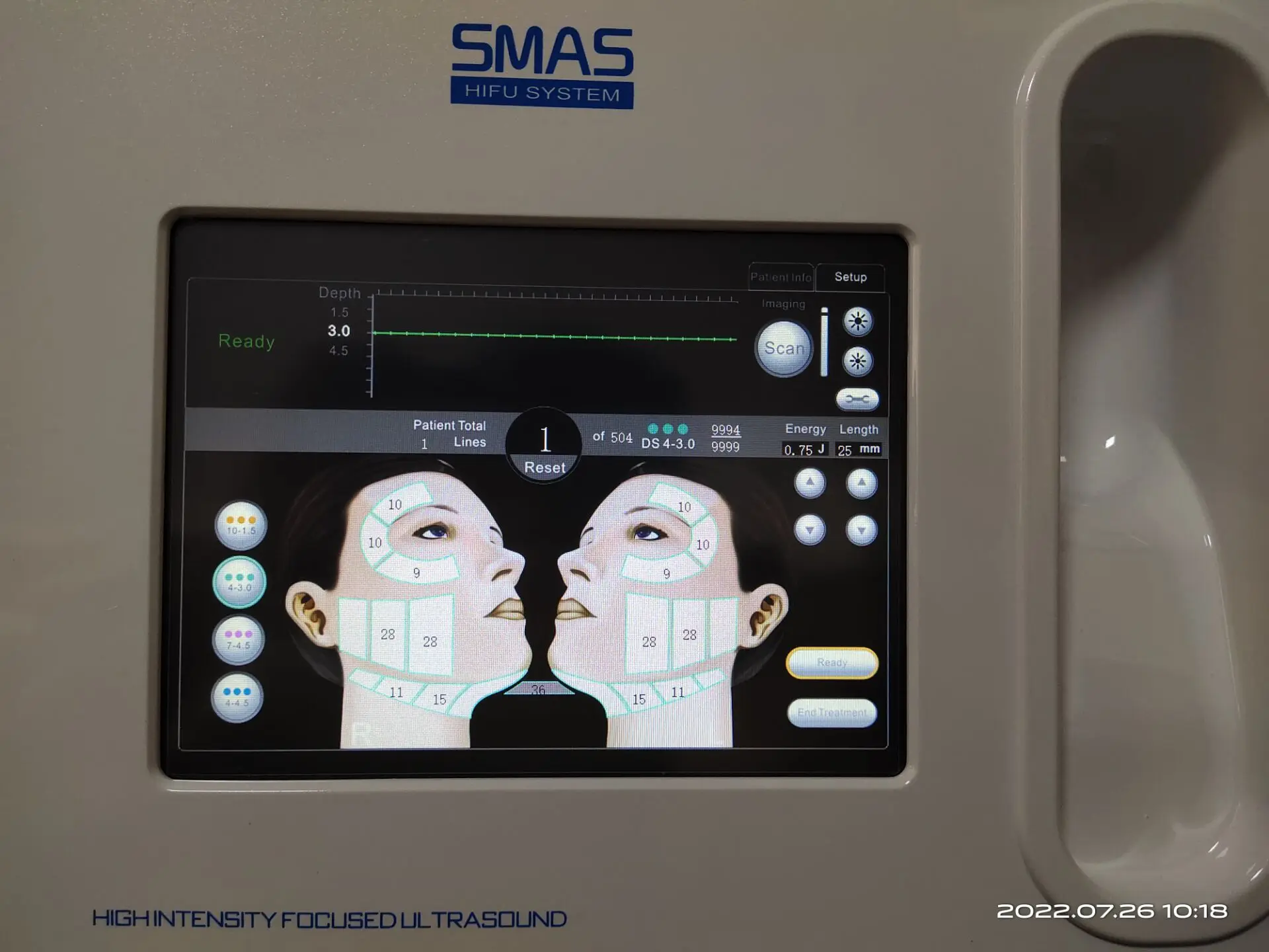 Portable Smas Skin Lifting Tightening Neck Lift Face Lifting Beauty ...