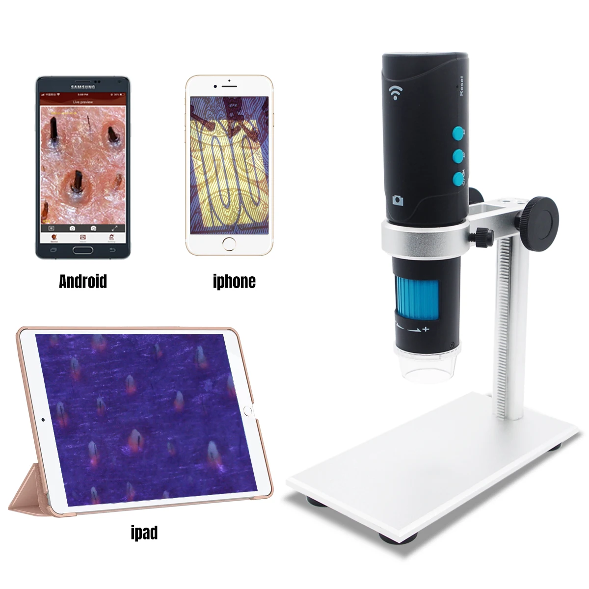 Toproview UV Wifi Dermatoscope - 10x to 200x Magnification