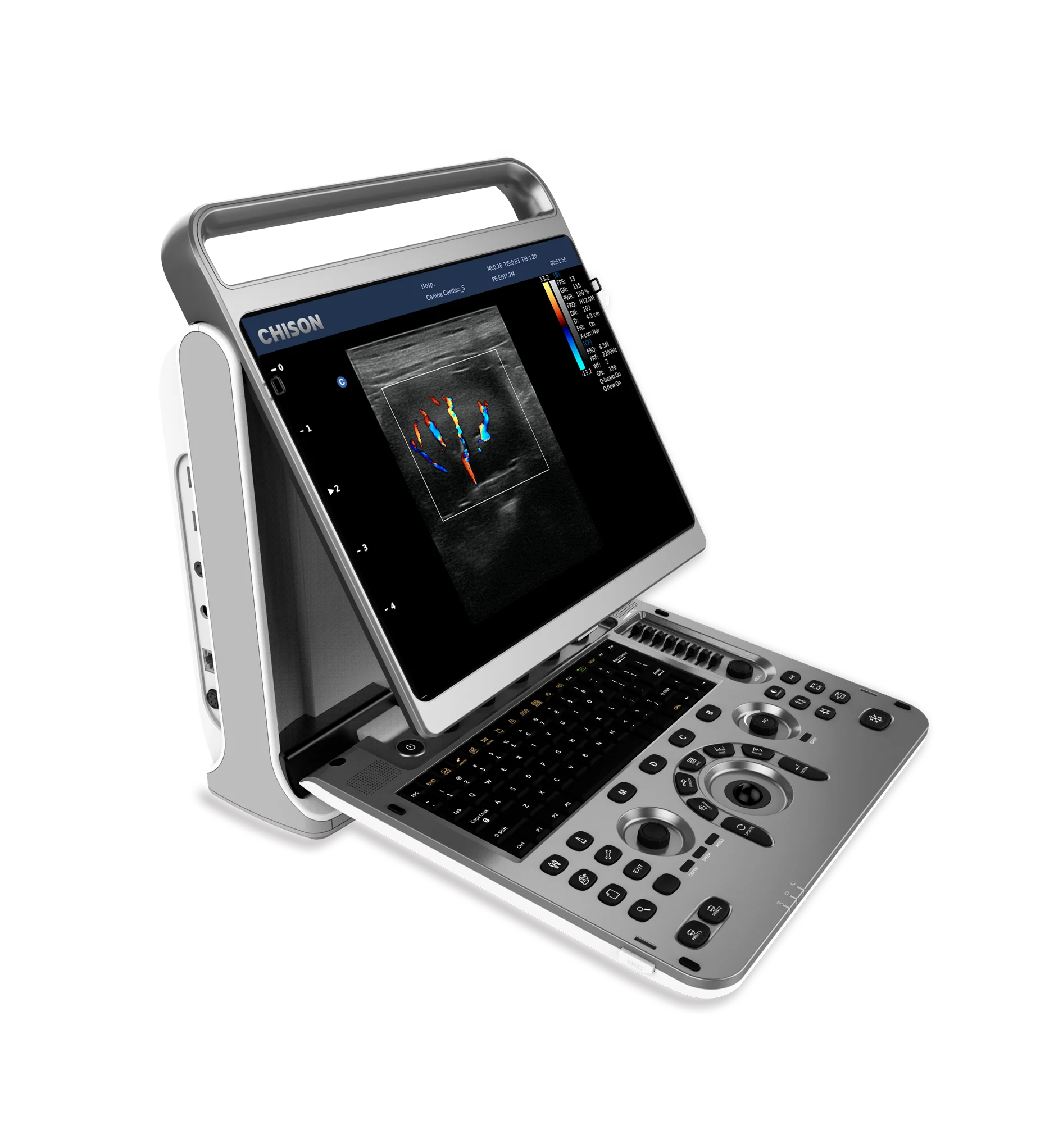 Medical Ultrasound Instruments Ebit30 Portable Ultrasound Machine - Buy ...