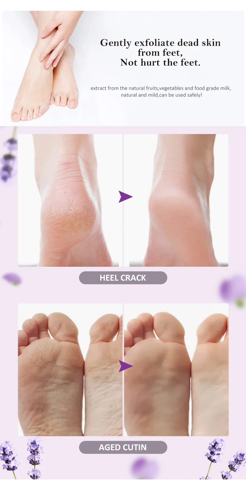 Exfoliating Foot Peel Mask - Natural Moisturizing Treatment