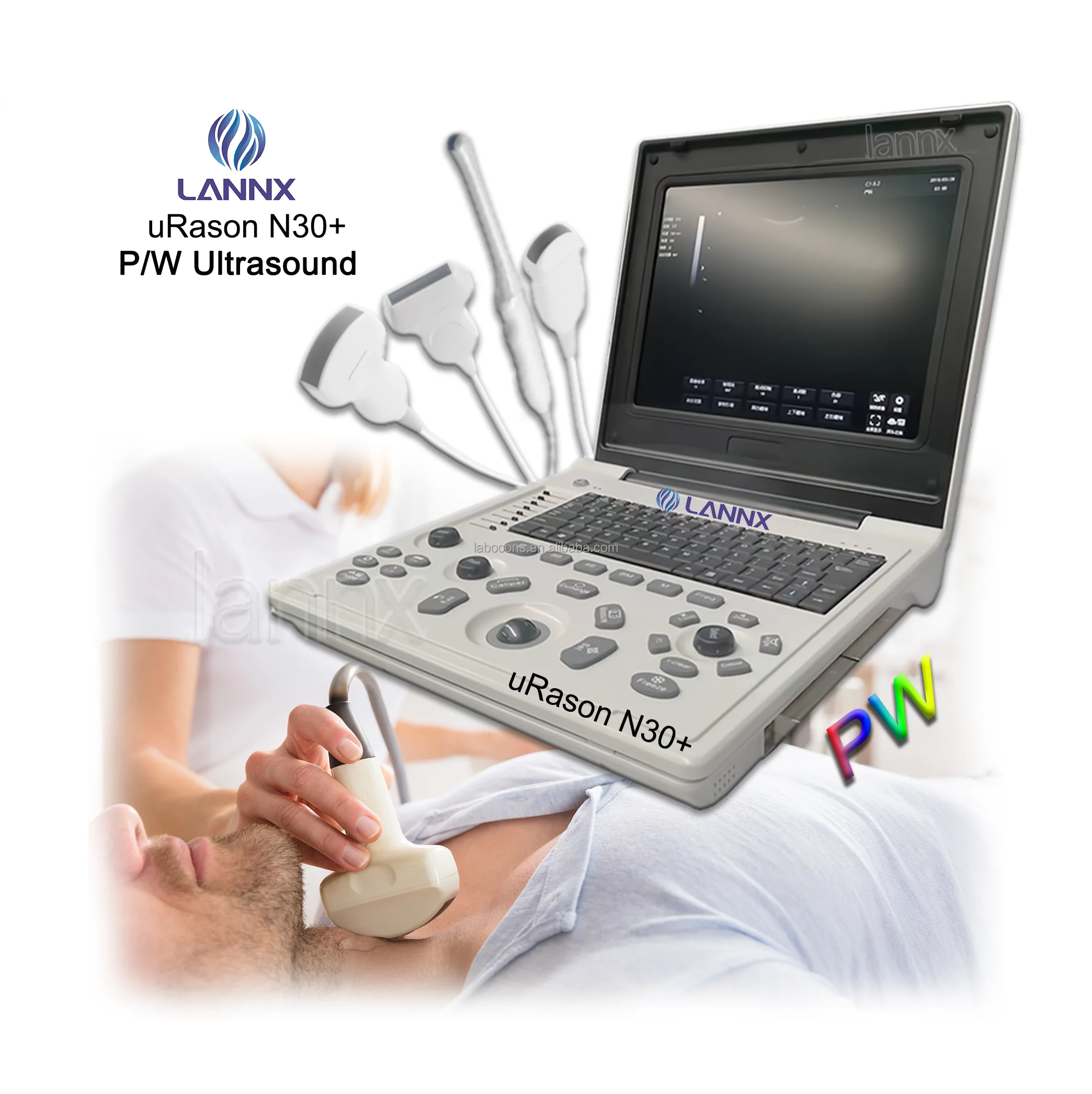 Lannx Urason N30+ Good Quality Medical Diagnosis Ultrasound Device Ultrasonic Scanner Without ...