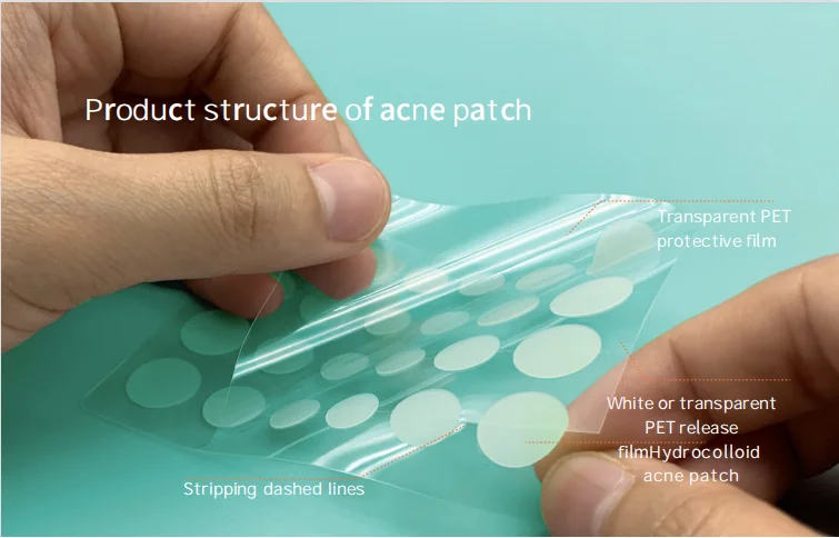 Large Circle Small Circle Acne Patch Wholesale Acne Pimple Patch 12dots ...