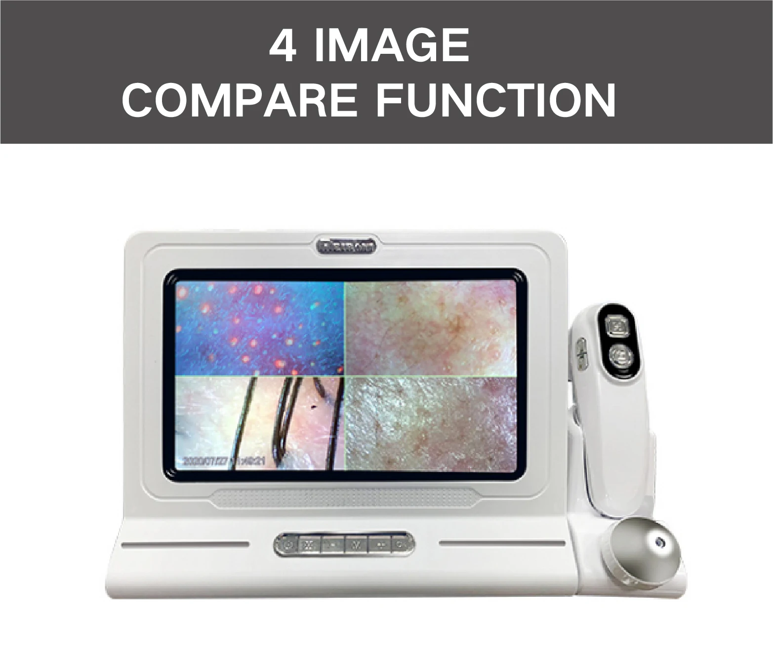 Trichoscope Hair and Scalp Analysis - Home & Commercial Use