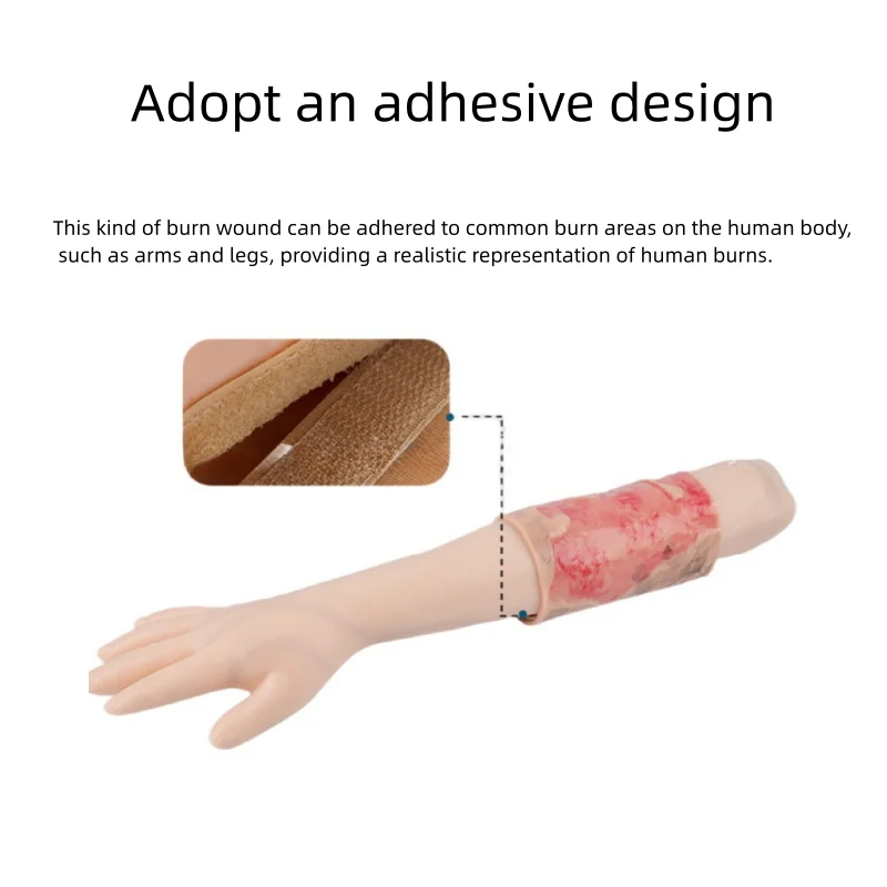 Real Life Simulation Model for Second Third Degree Limb Burns Training ...