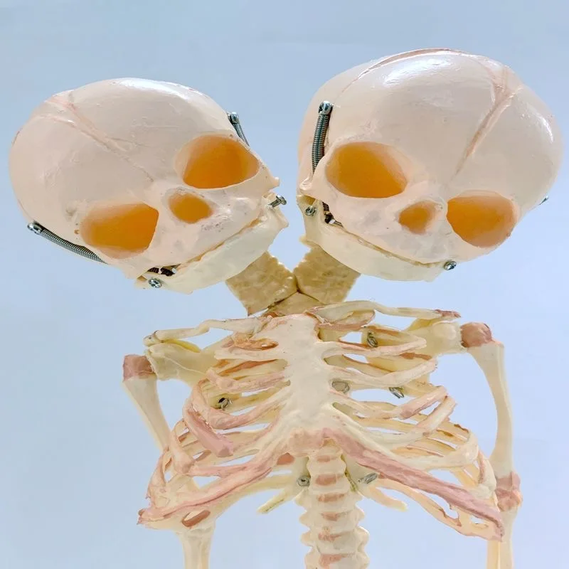 Kyrenmed Double Head Baby Anatomy Model for Medical Study