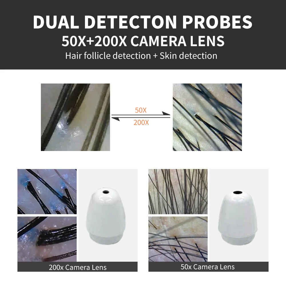 High Quality Hd Hair Follicles Scalp Scanner Detector Hair Analyzer ...