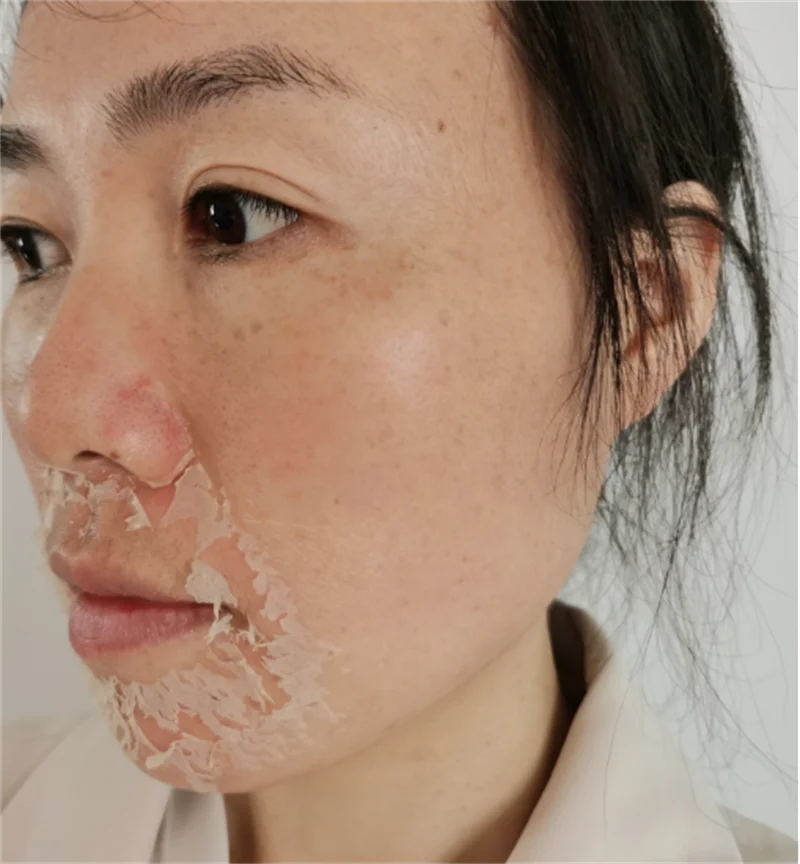 Seaweed Microneedling - Spongilla Spicules Powder 2024G