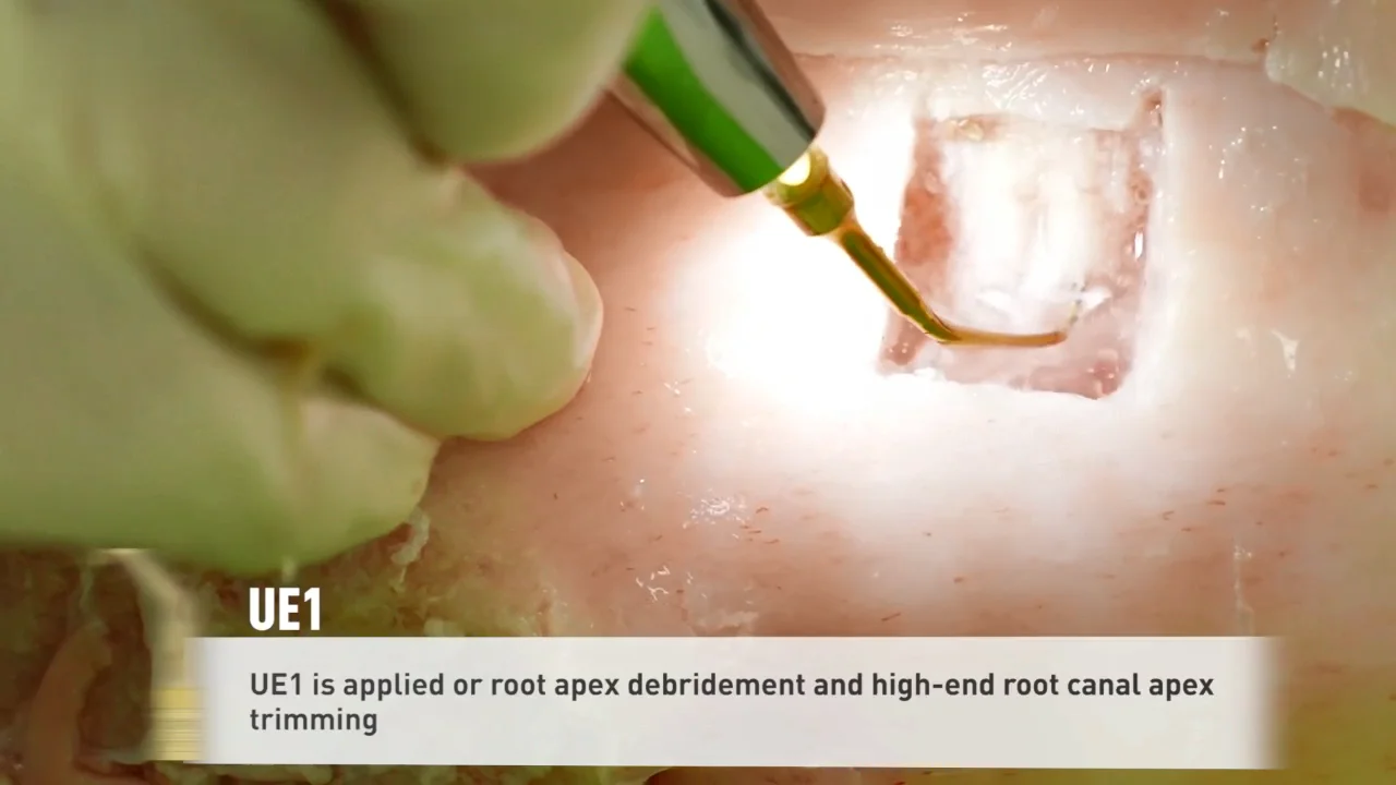 Dental Ultrasonic Piezoelectric Surgery Bone Knife Wireless Pedal ...