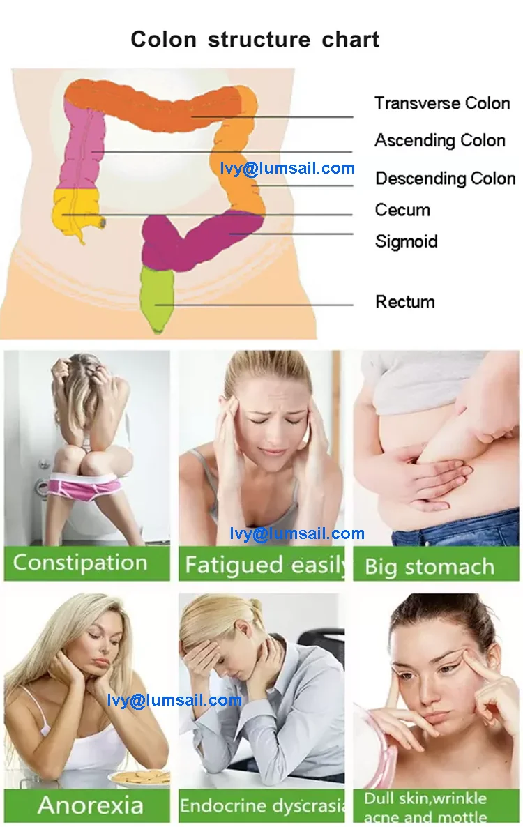 Colonic Tubes Catheter for Colon Hydrotherapy Equipment