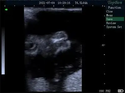 Hiyi Chy8 Professional Digital B-ultrasound Diagnostic Instrument For ...