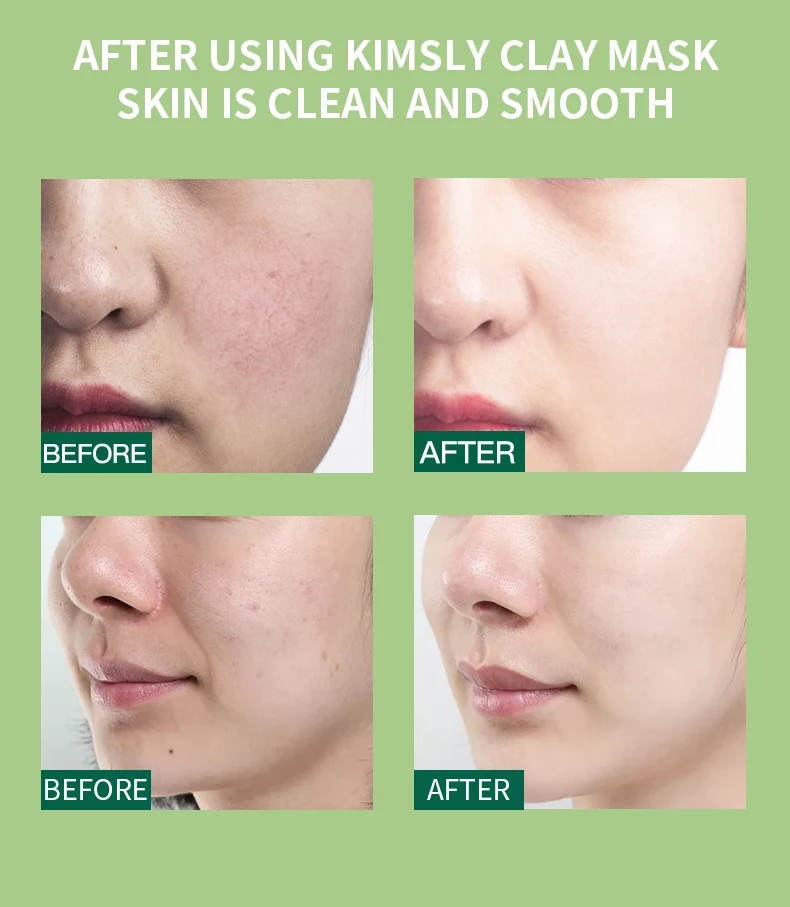 Private Label Organic Skin Care Turmeric Oil Control Pink Rose Clay ...