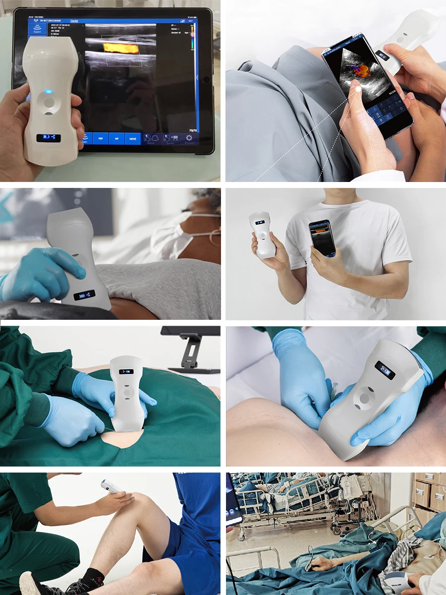 Suresult URason W6 Wireless Ecografo Color Ultrasound Probe Scanner Linear USG Probes Smartphone ...