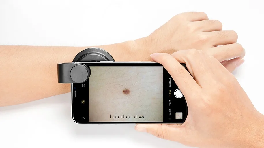 Iboolo De-400 Electric Dermatoscope With Both Nonpolarized And ...