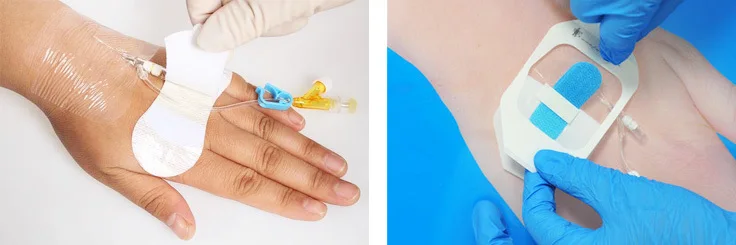 Catheter Fixation Device Picc Catheter Fixing Holder China Factory ...