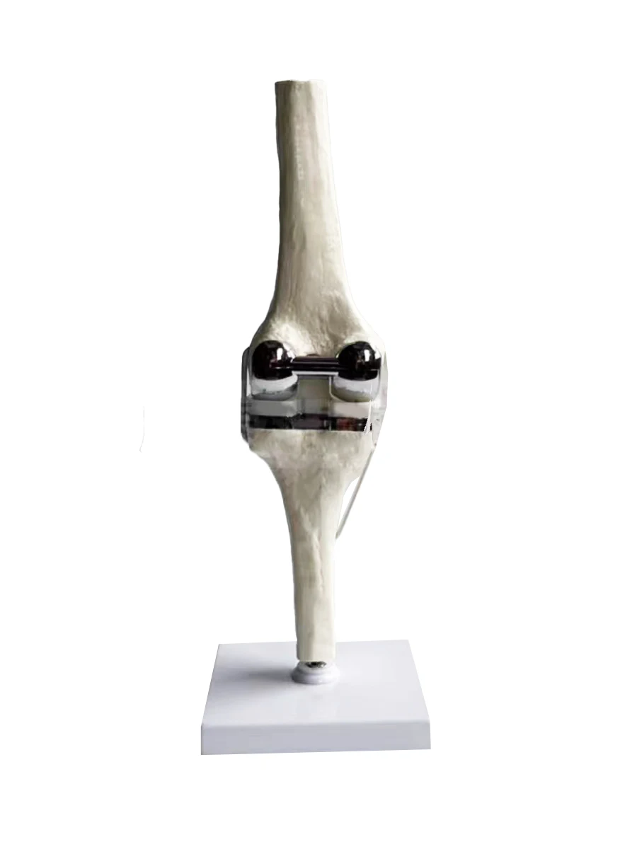 Life Size Artificial Human Knee Anatomy Model For Medical Teaching ...