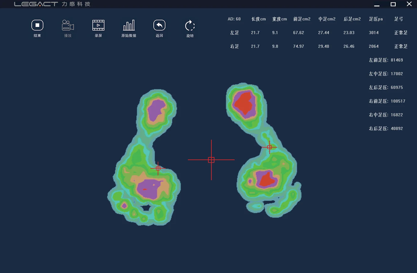 Customizable Pattern Footprint FSR Arrayed Pressure Distribution Kit ...
