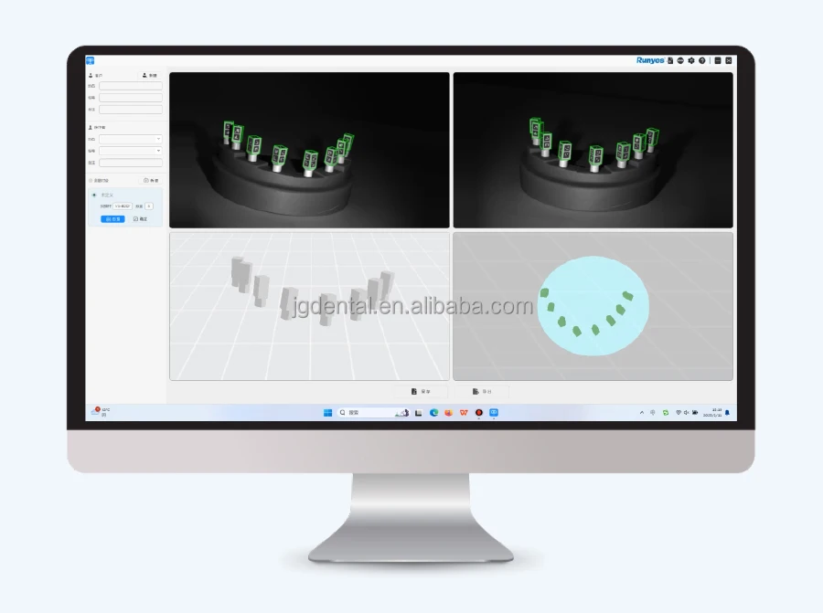 Dental Photogrammetry Scans - Precise Implants Capture