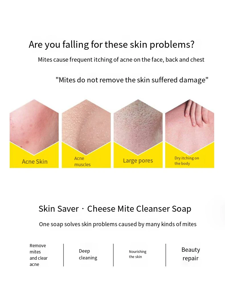 Moisturizing Cheese Handmade Soap - Anti Acne & Whitening