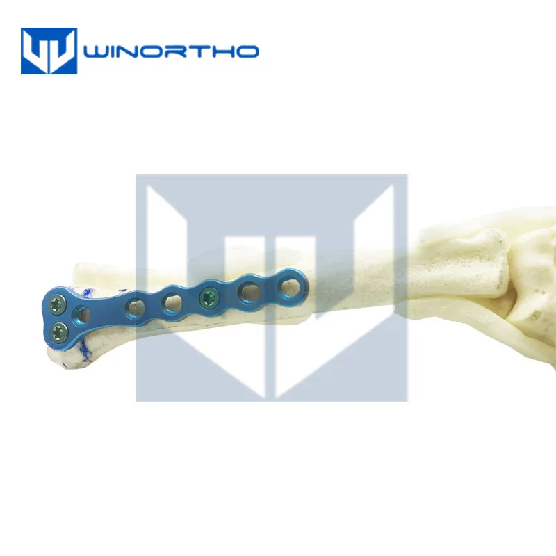 Veterinary Cuttable Animal Bone Reconstruction Plate Orthopedic ...