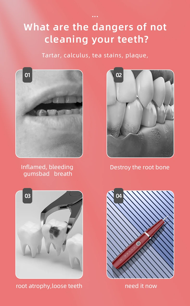 Electric Sonic Dental Calculus Plaque Remover Tool Kit Tooth Scraper ...