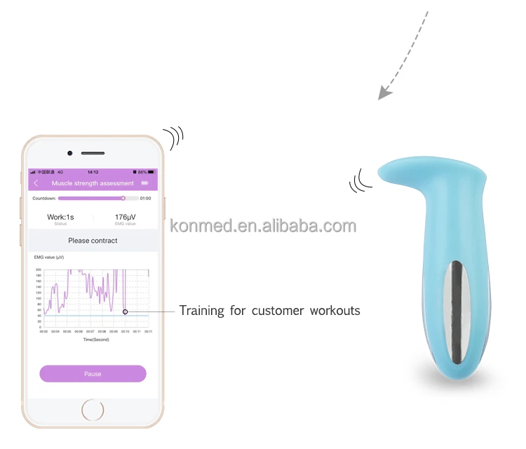 Kegel Exercise Ems Emg Device Rehabilitation Trainer For Women ...