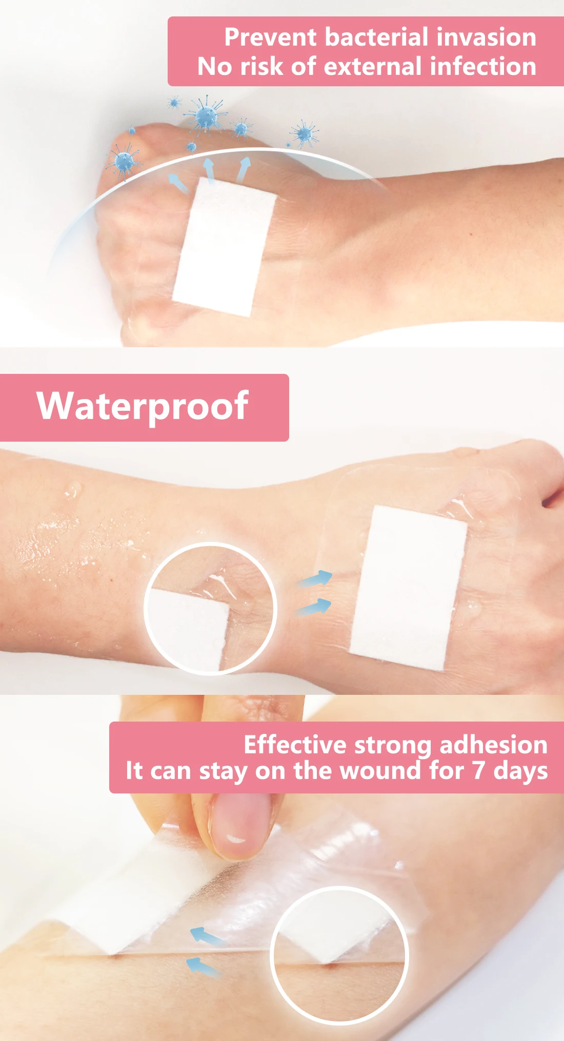Bluenjoy Adhesive Sterile Medical Use Pu Film Adhesive Wound Care ...